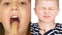 Symptoms of Strep Throat in Kids: How to Identify Them Early