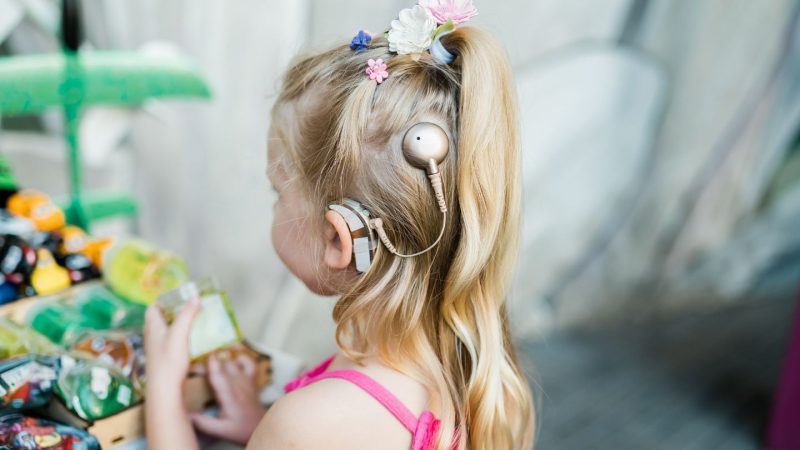 Top Benefits of Cochlear Implants for Kids: Key Advantages