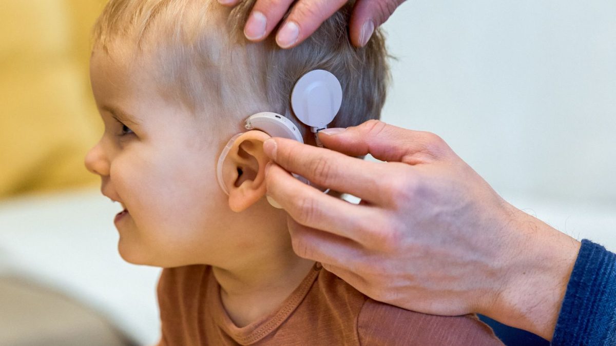 Is Your Child Eligible For Pediatric Cochlear Implants?