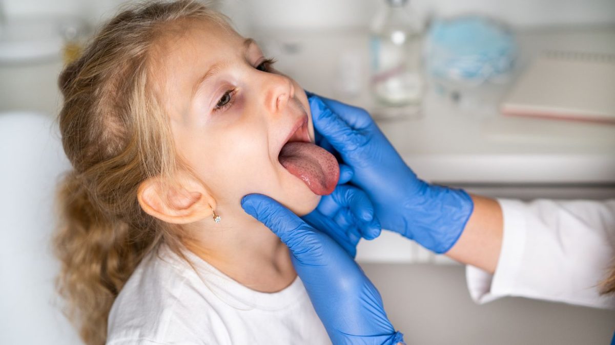 Laser vs. Surgical Frenectomy: Key Differences Explained